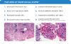 Measures of Disease Severity in EoE Histology
