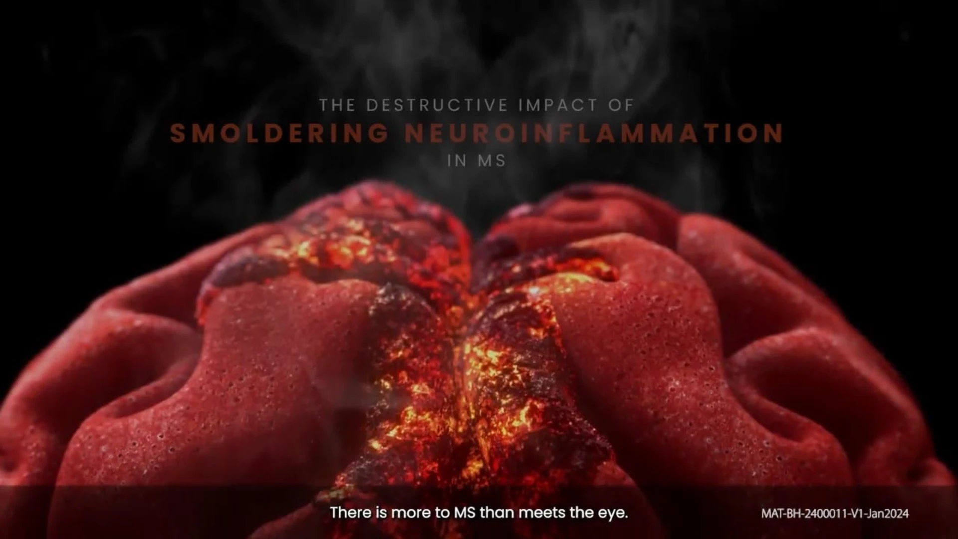 Smoldering Neuroinflammation