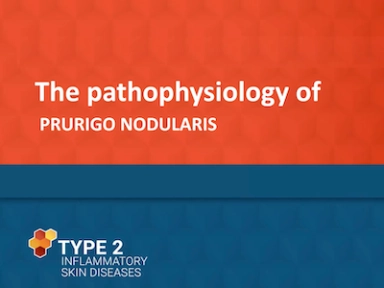 Prurigo Nodularis