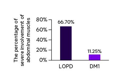 Differential diagnosis of Late Onset Pompe Disease (LOPD) and myotonic ...