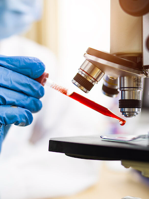 Identifying and Treating Patients with High Lipidaemia Risk Post-ACS