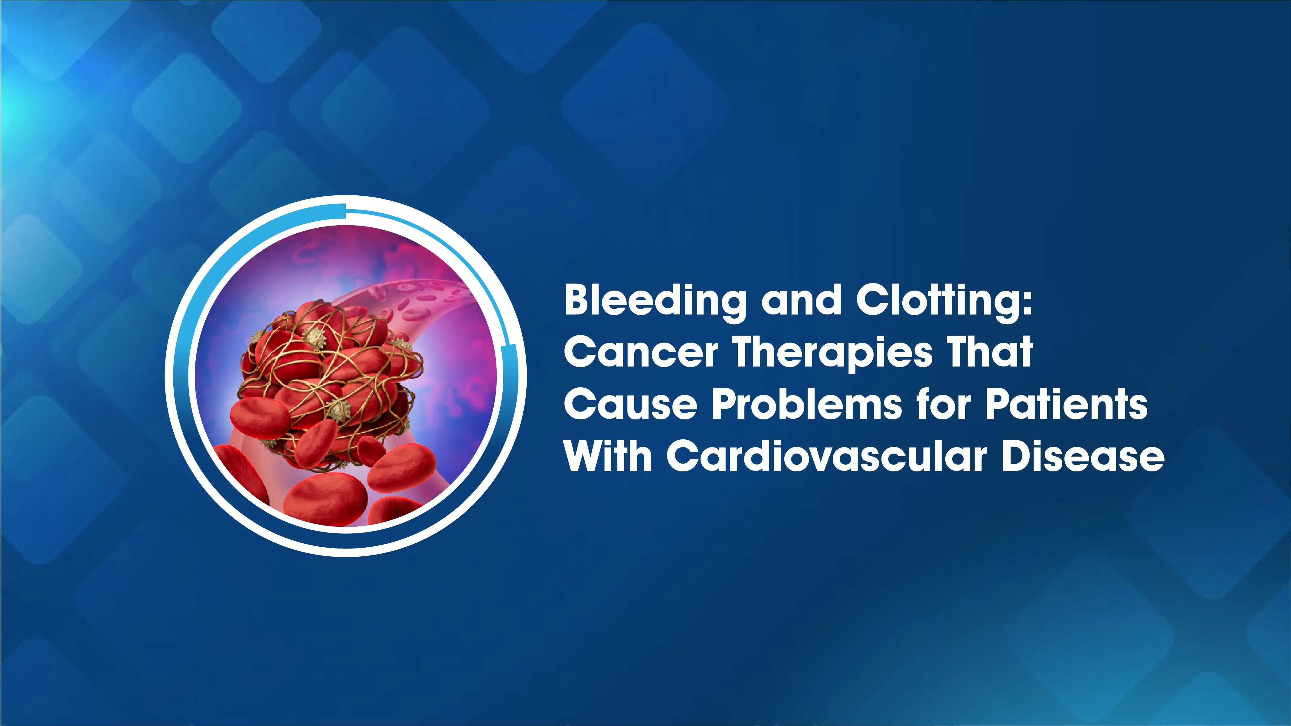 Bleeding and Clotting: Cancer Therapies That Cause Problems for ...